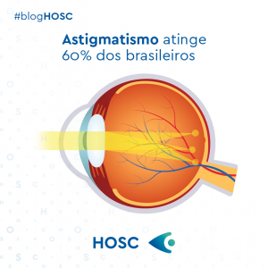 Astigmatismo: sintomas, diagnóstico e tratamento – Hospital de Olhos de ...