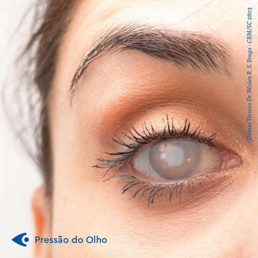 Pressão ocular: entenda como ela acontece. – Hospital de Olhos de Santa ... Pressão ocular: entenda como ela acontece. – Hospital de Olhos de Santa ...