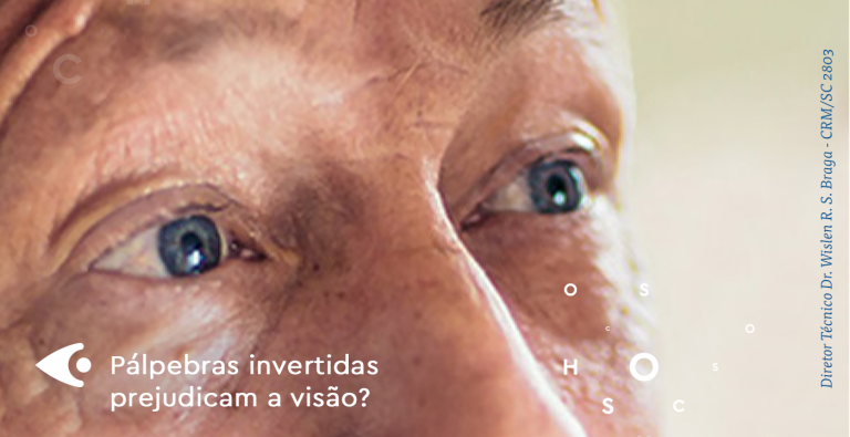 Entrópio: a condição das pálpebras invertidas – Hospital de Olhos de ...